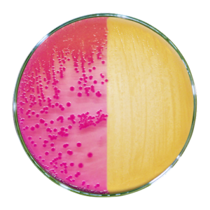 Why Do We See Different Colours in Differential Media Plates?