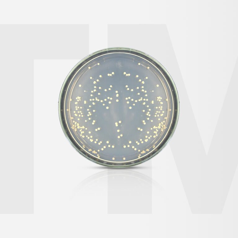Step-by-Step Guide to Decoding Nutrient Agar for Microbiology