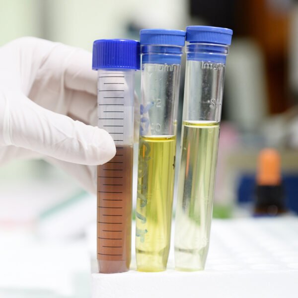 Thioglycollate Broth in Microbiology: Oxygen Requirement Testing